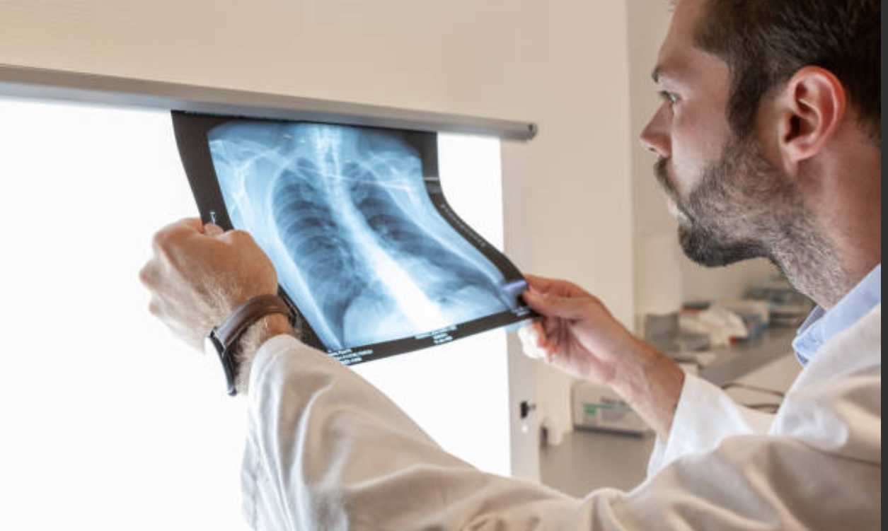 X-Ray Radiation Exposure: Doses & Risks - EMF Empowerment